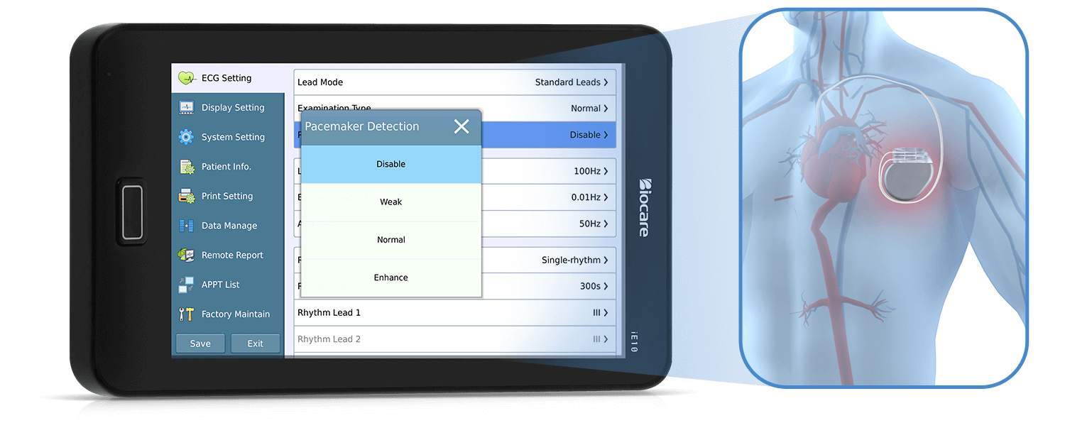 Point-of-Care 12-Lead ECG/EKG Machine Based on A Tablet, with Auto ...